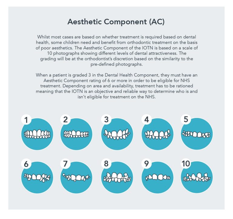 IOTN Orthodontics Explained - Portman Smile Clinic Bicester